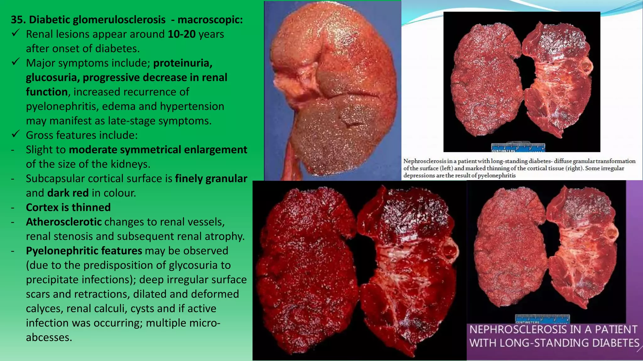 PMU third/fourth year Clinical pathoanatomy Part 3 | PPTX