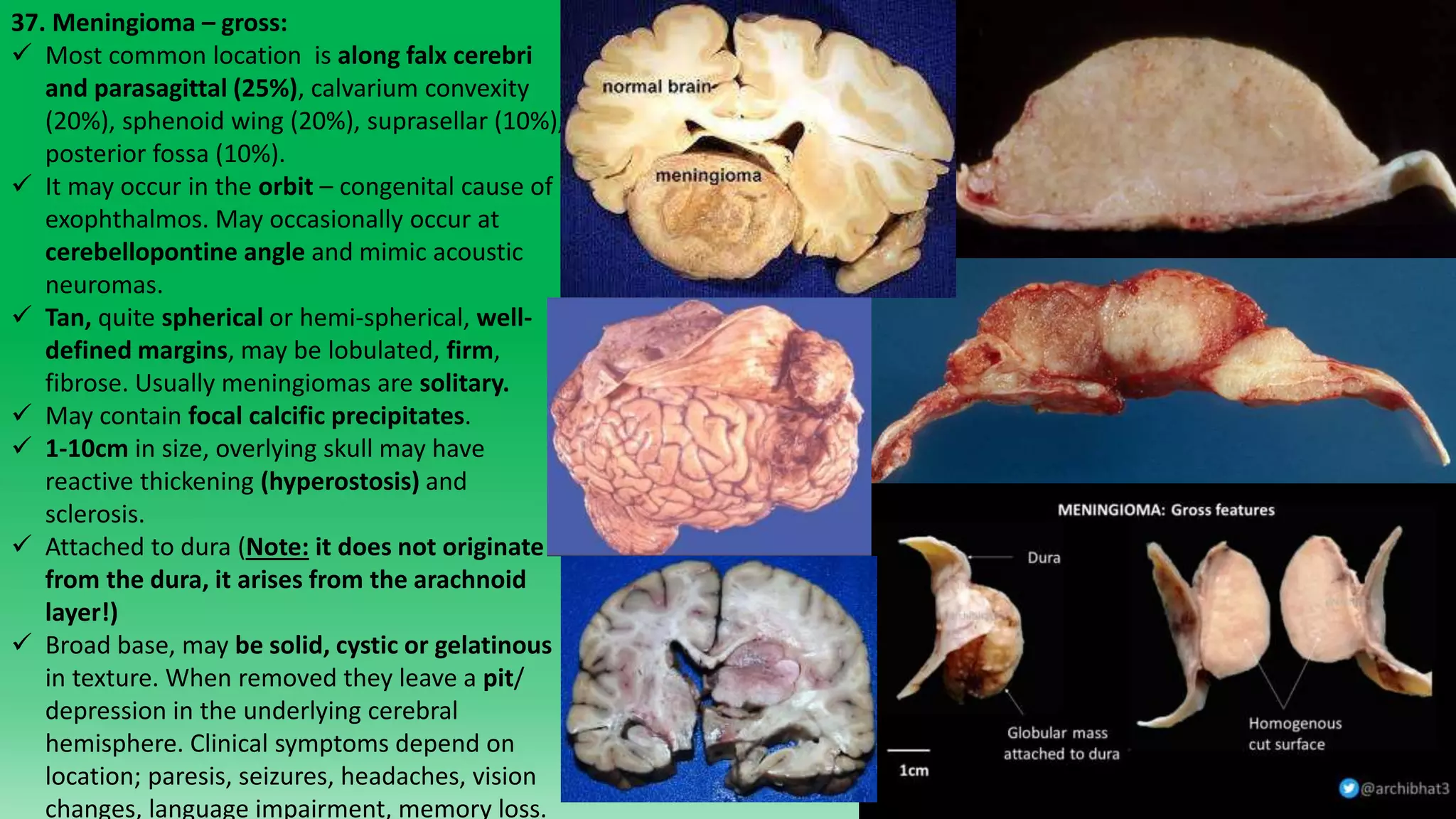 PMU third/fourth year Clinical pathoanatomy Part 3 | PPTX