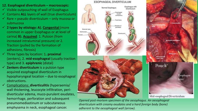 PMU third/fourth year Clinical pathoanatomy Part 3 | PPTX
