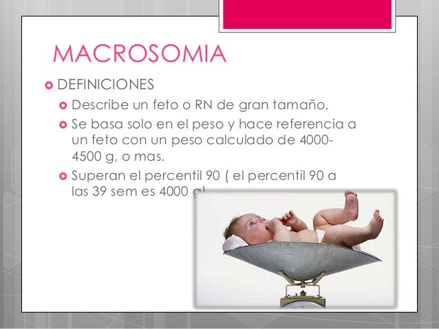 Macrosomia. embarazo multiple
