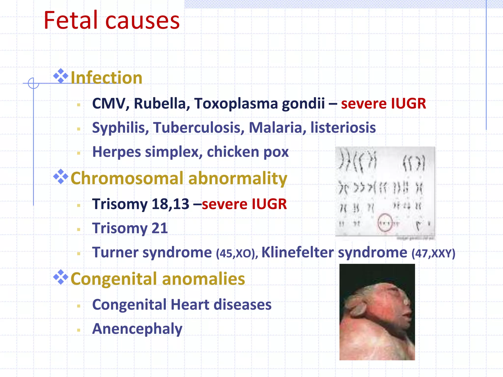Macrosomia and iugr with case study for undergraduare | PPSX