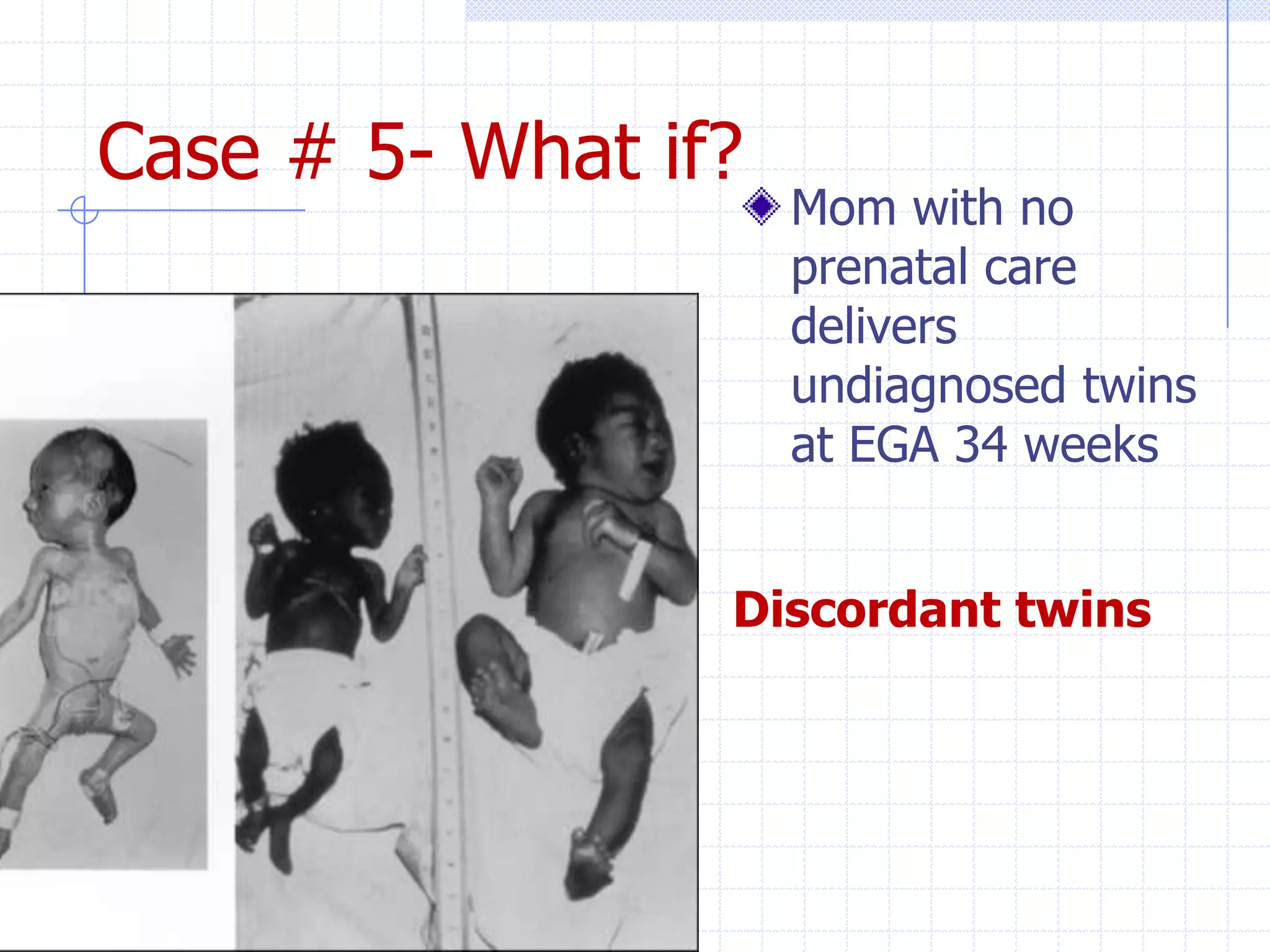 Macrosomia and iugr with case study for undergraduare | PPSX