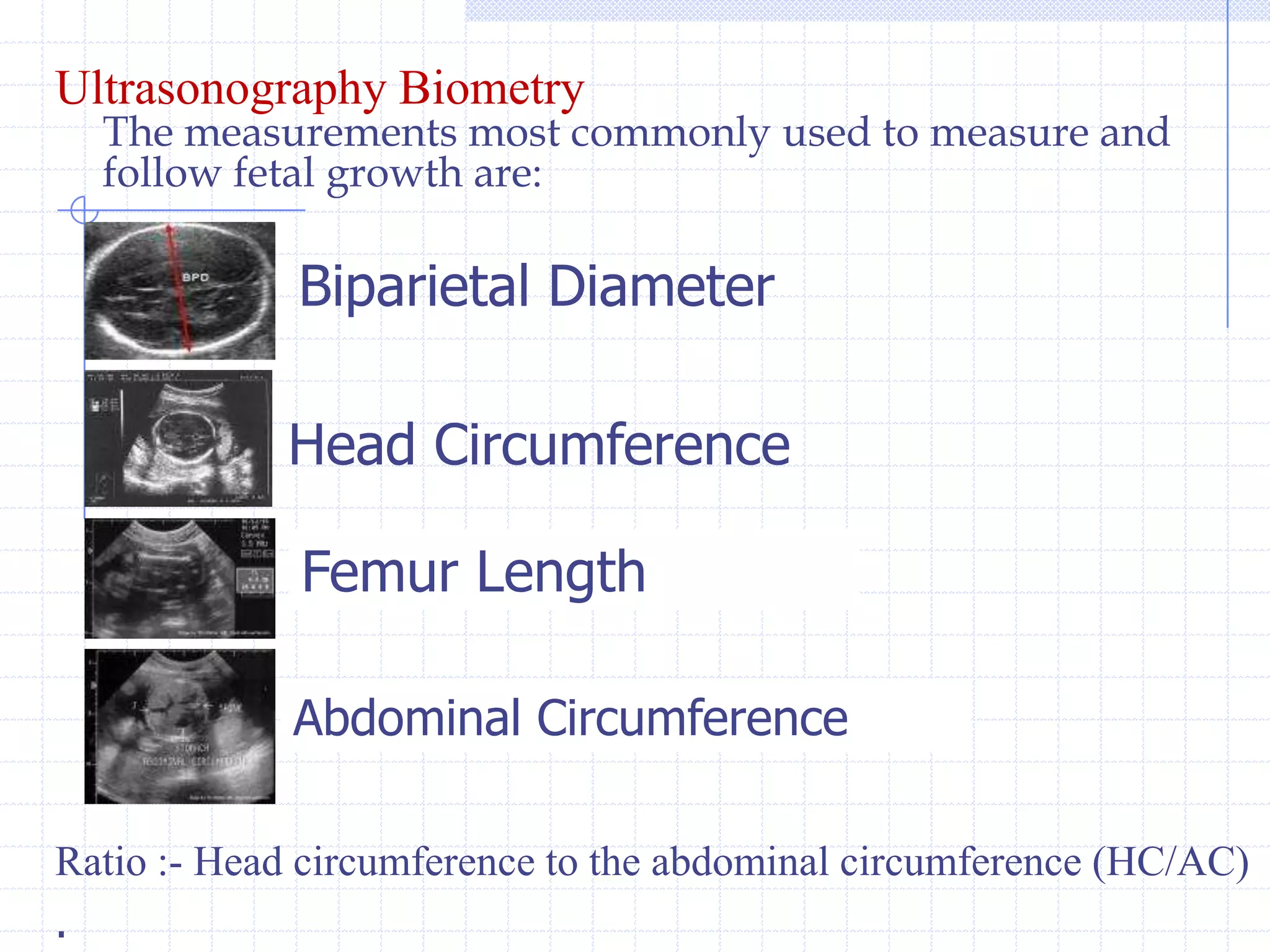 Macrosomia and iugr with case study for undergraduare | PPSX