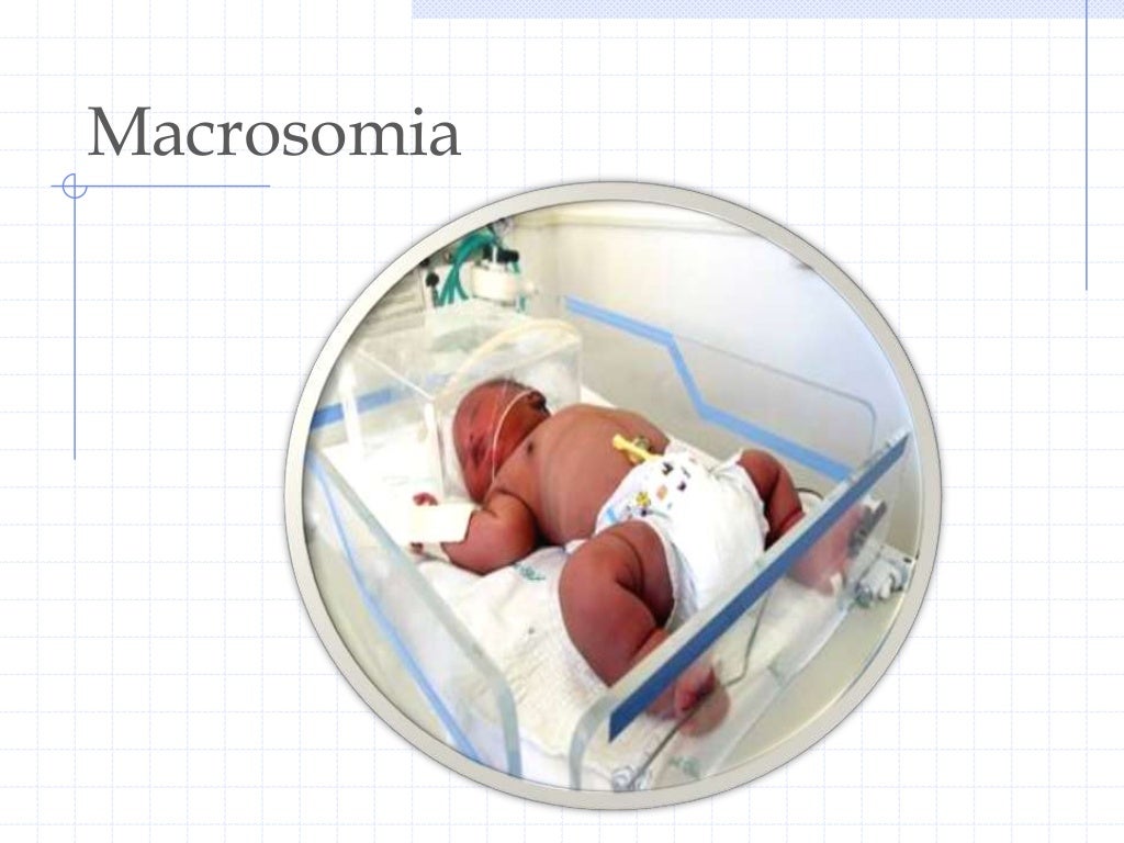Macrosomia and iugr with case study for undergraduare