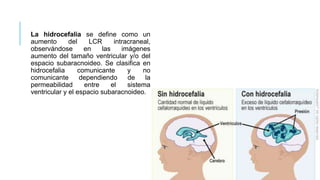 macro y microcefalia | PPTX