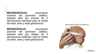 macro y microcefalia | PPTX