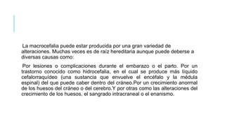 macro y microcefalia | PPTX