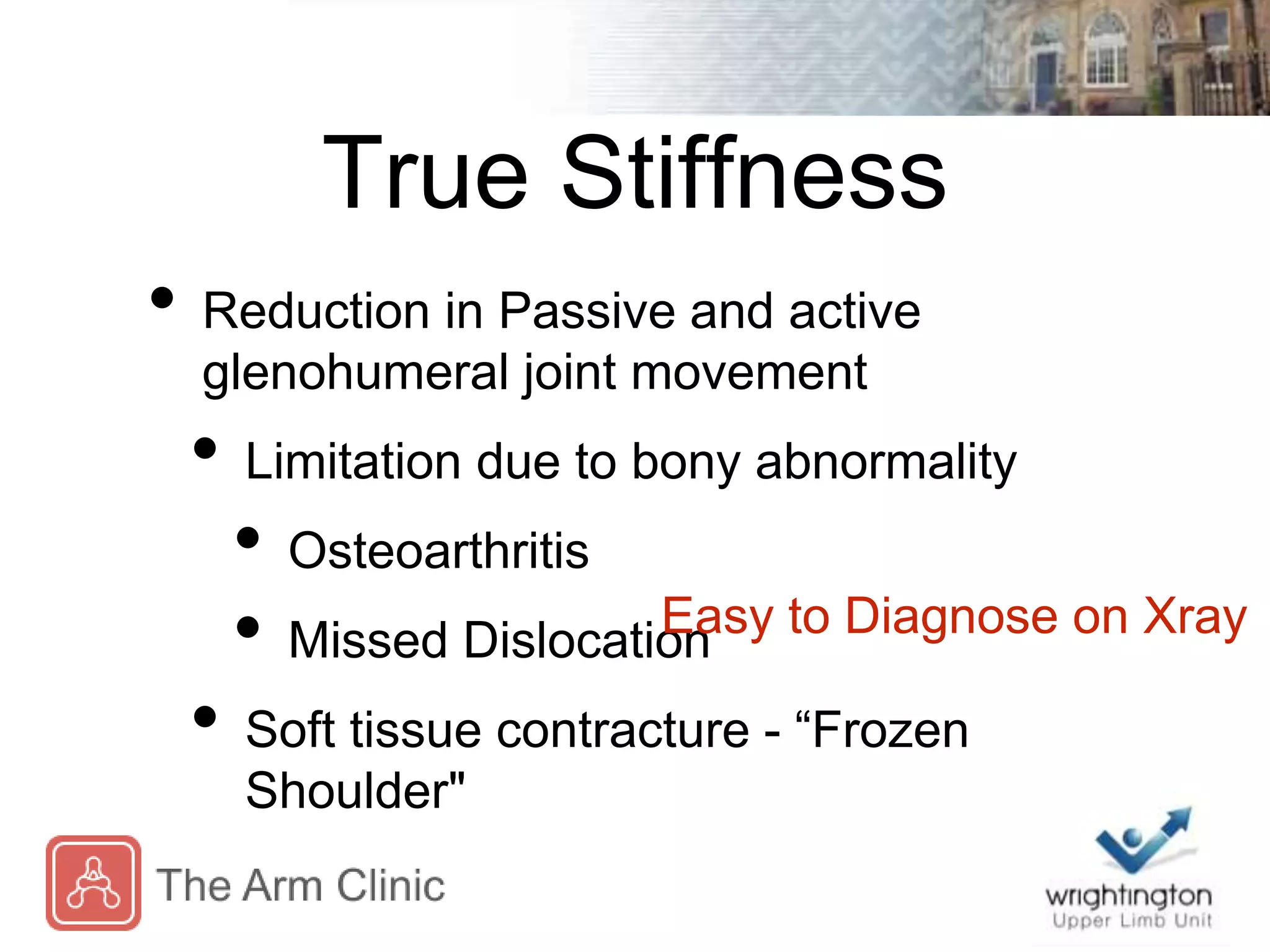 Assessment and Management of Frozen Shoulder | PPTX