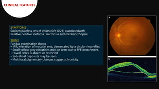 MACULAR DISORDERS POWERPOINT PRESENTATION | PPTX