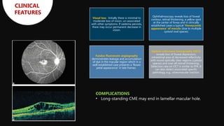 MACULAR DISORDERS POWERPOINT PRESENTATION | PPTX