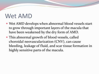 Macular degeneration | PPTX