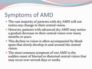 Macular degeneration | PPTX