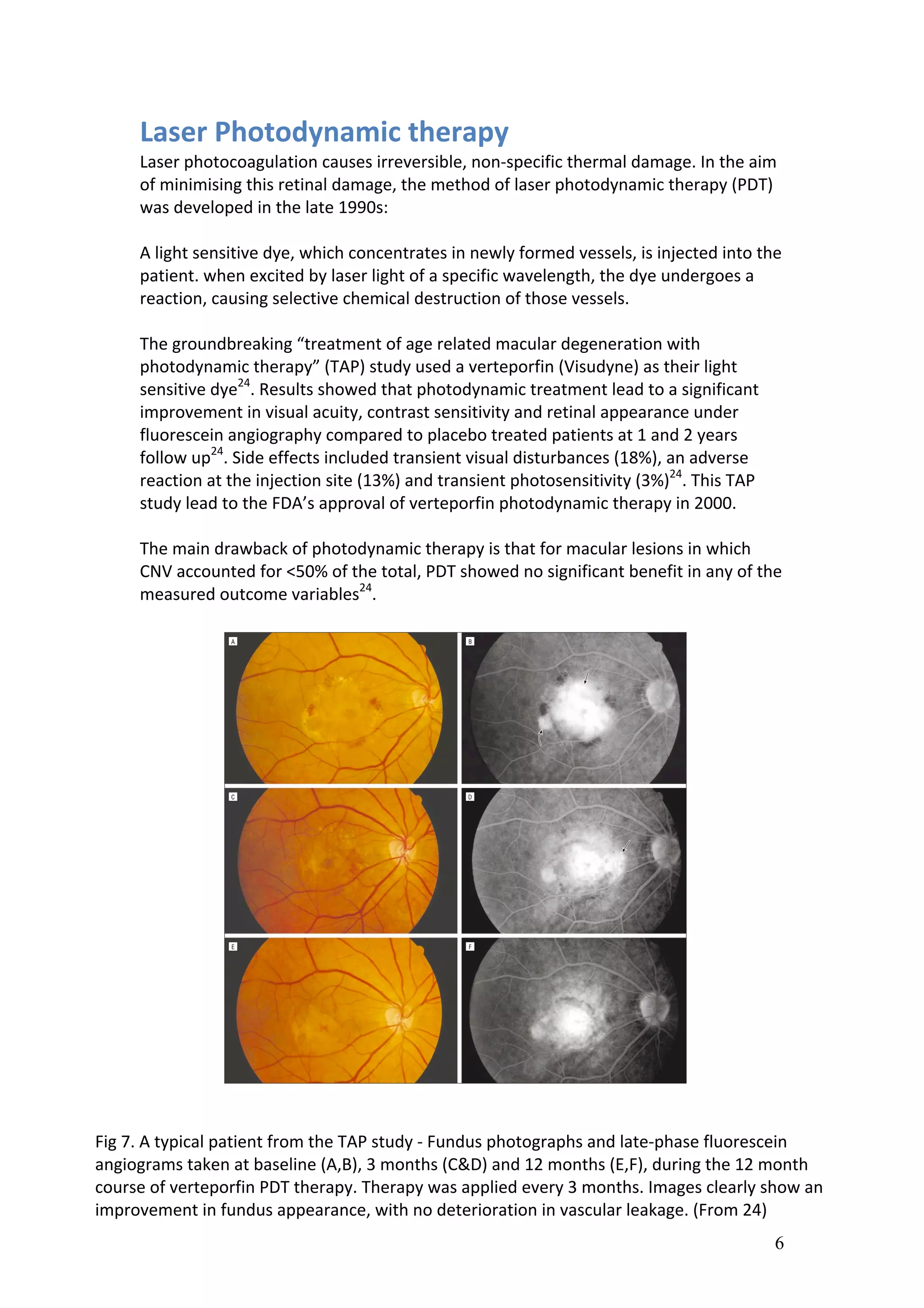 macular degeneration therapy | PDF