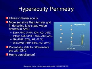 Macular Function Surveillance Revisited | PPT