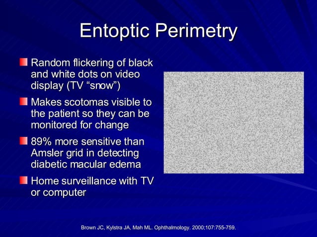 Macular Function Surveillance Revisited | PPT | Eye and Vision ...