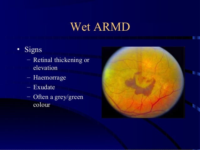 Macular Degeneration