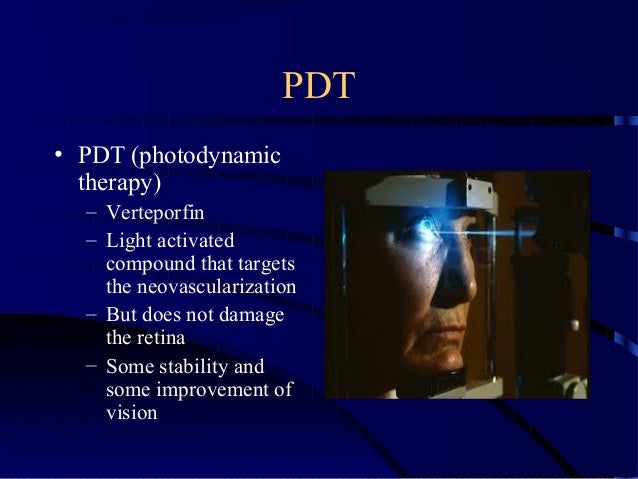 Macular Degeneration