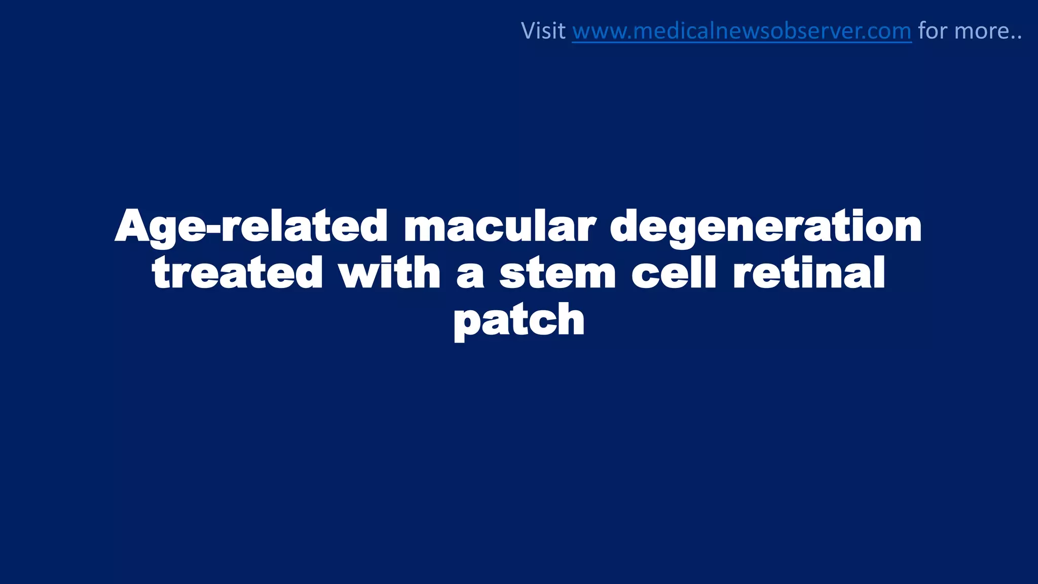 Macular degeneration treated with a stem cells | PPTX