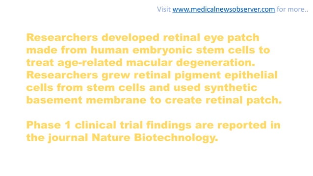 Macular degeneration treated with a stem cells | PPT