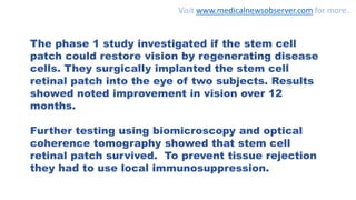 Macular degeneration treated with a stem cells | PPTX