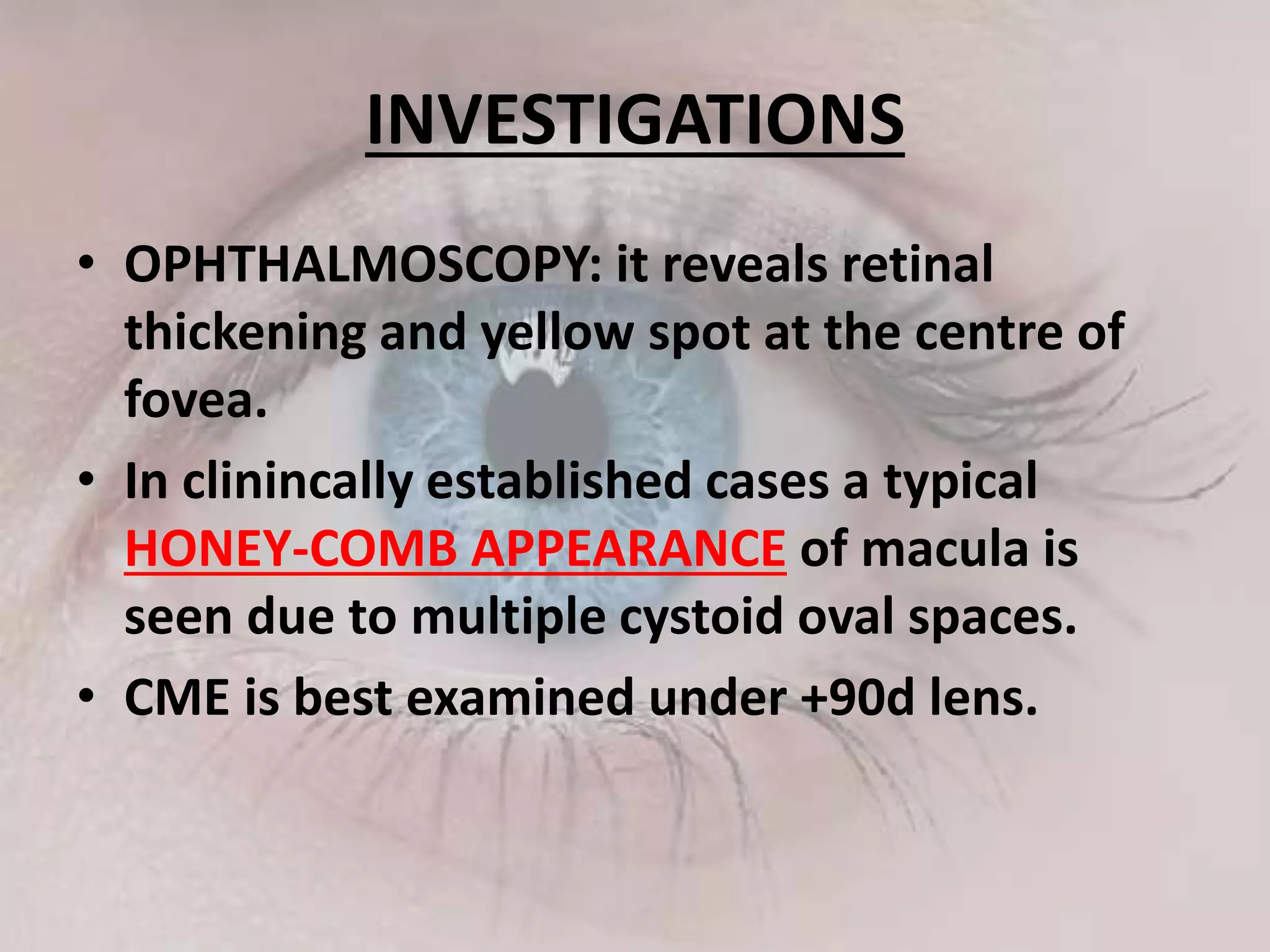 MACULAR DISORDERS.pptx