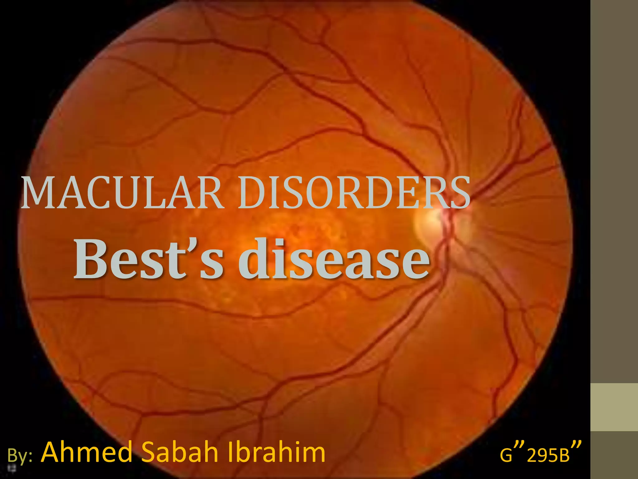 Macular disorders best disease | PPTX