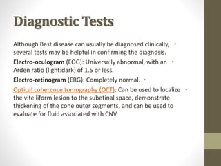 Macular disorders best disease | PPTX
