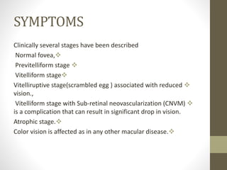Macular disorders best disease | PPTX