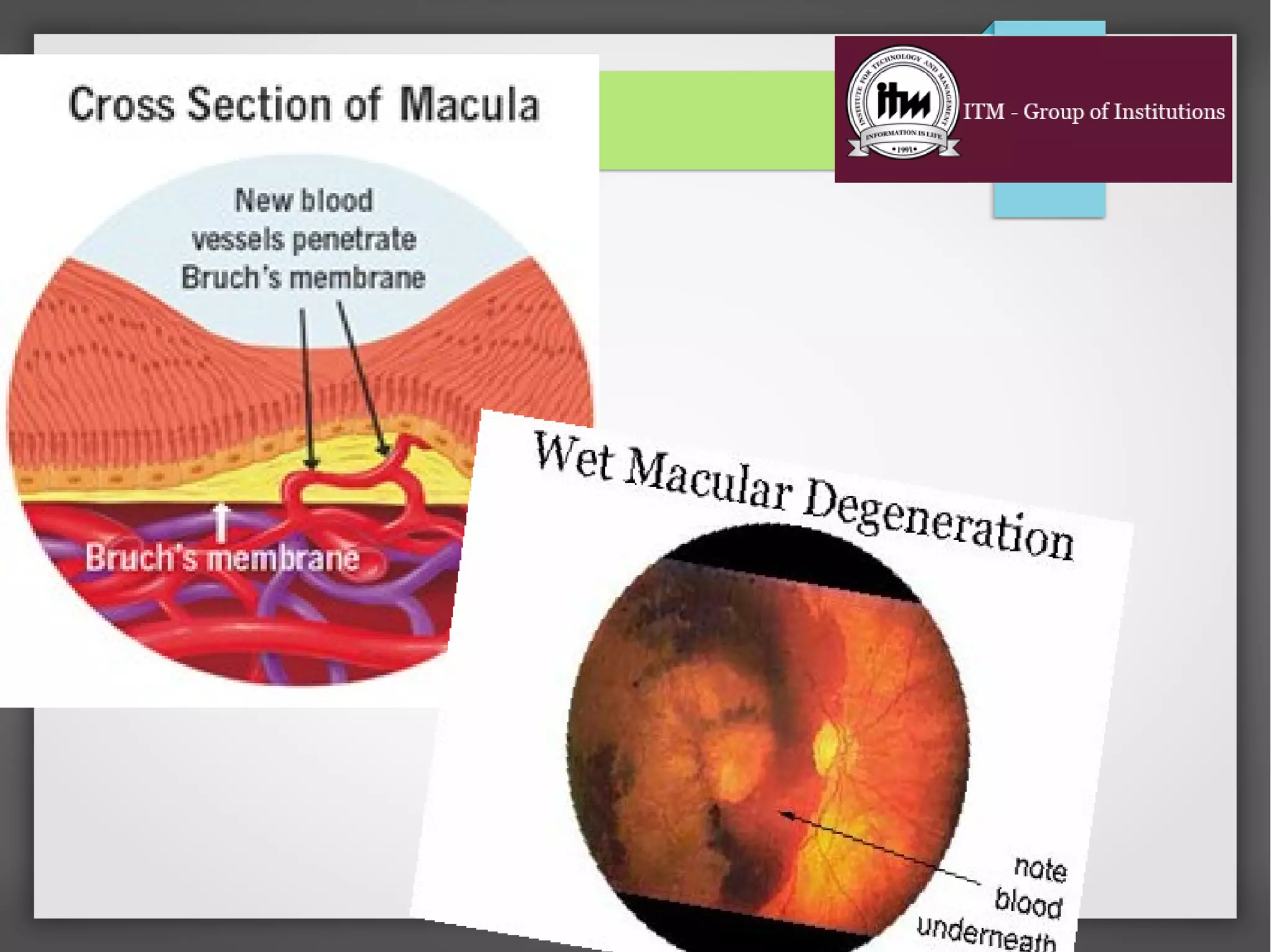 Macular function test | ODP