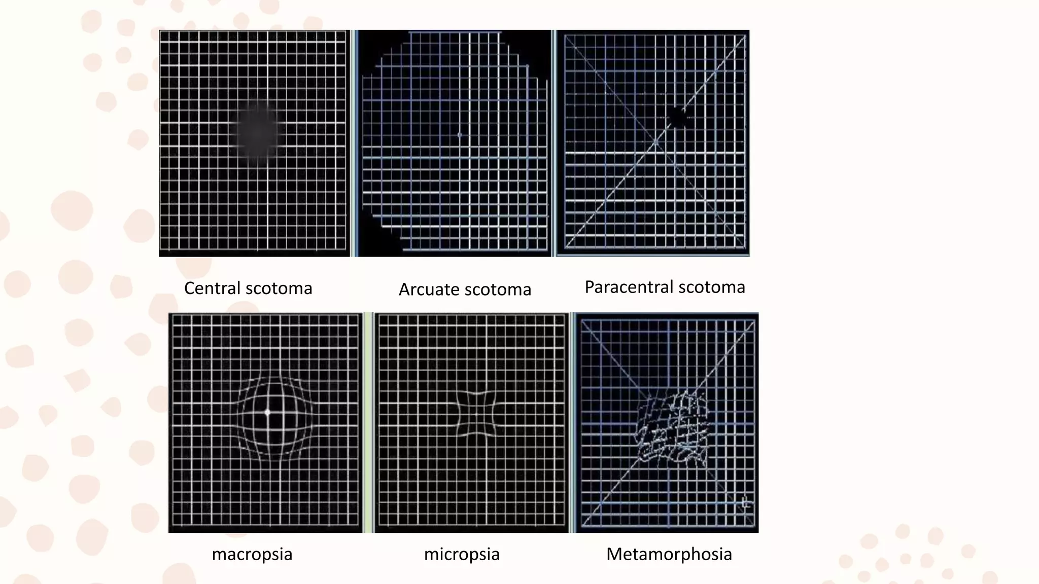Macular function test | PPTX