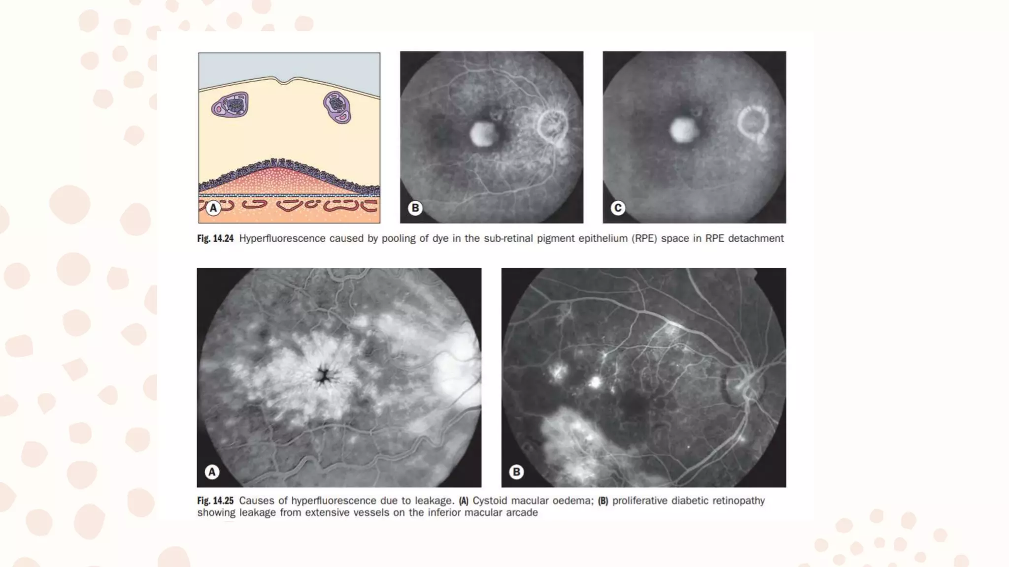 Macular function test | PPTX