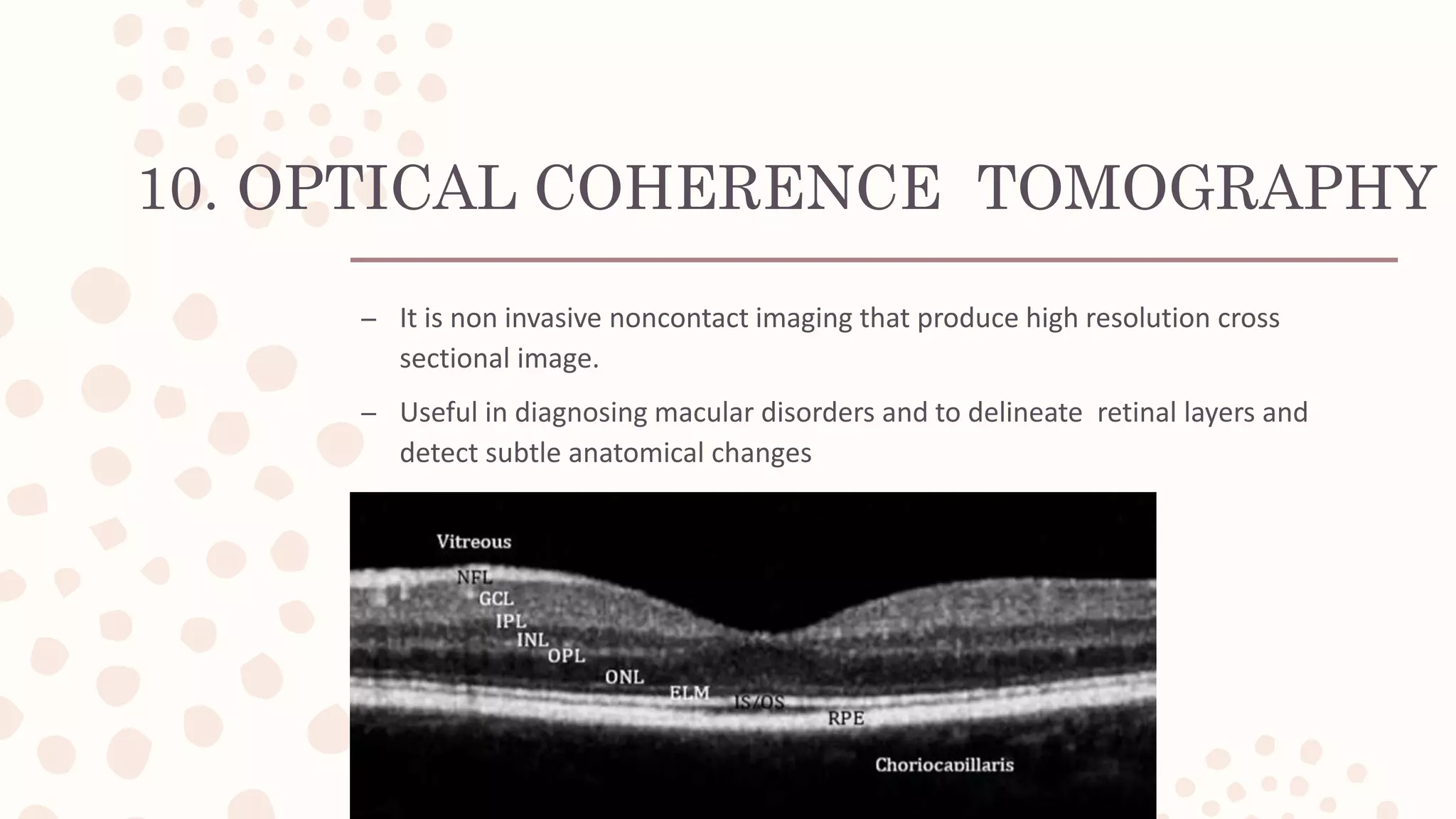 Macular function test | PPTX
