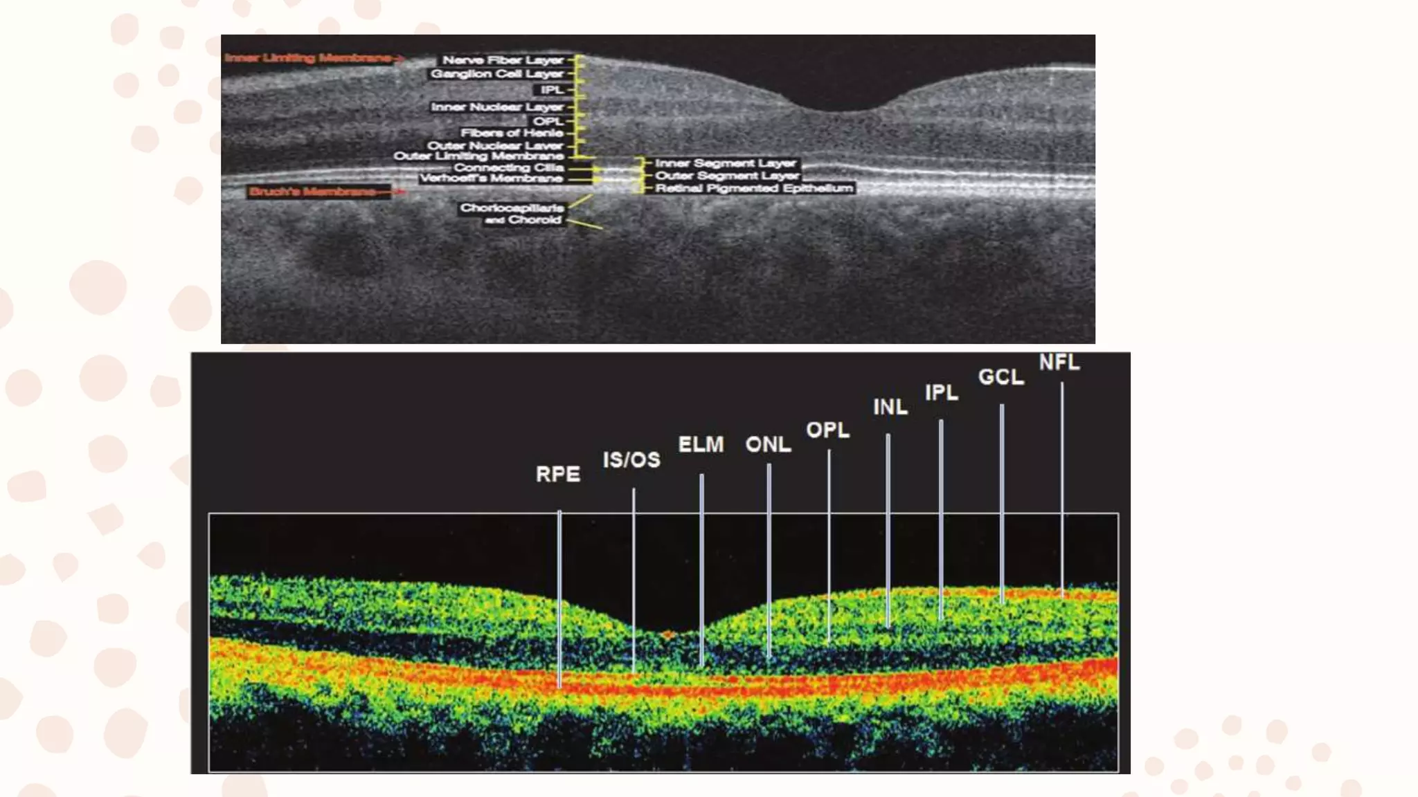 Macular function test | PPTX