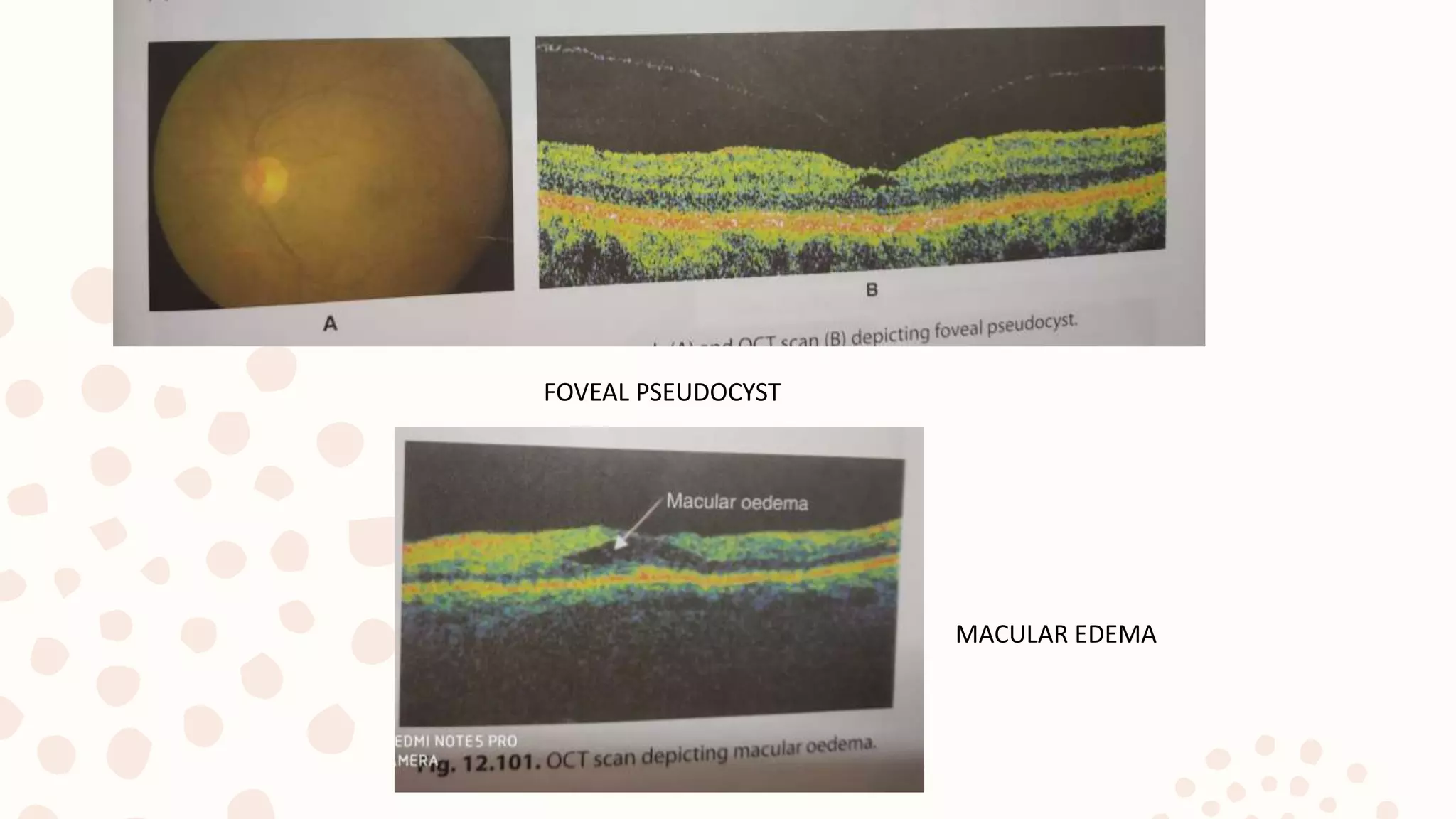 Macular function test | PPTX