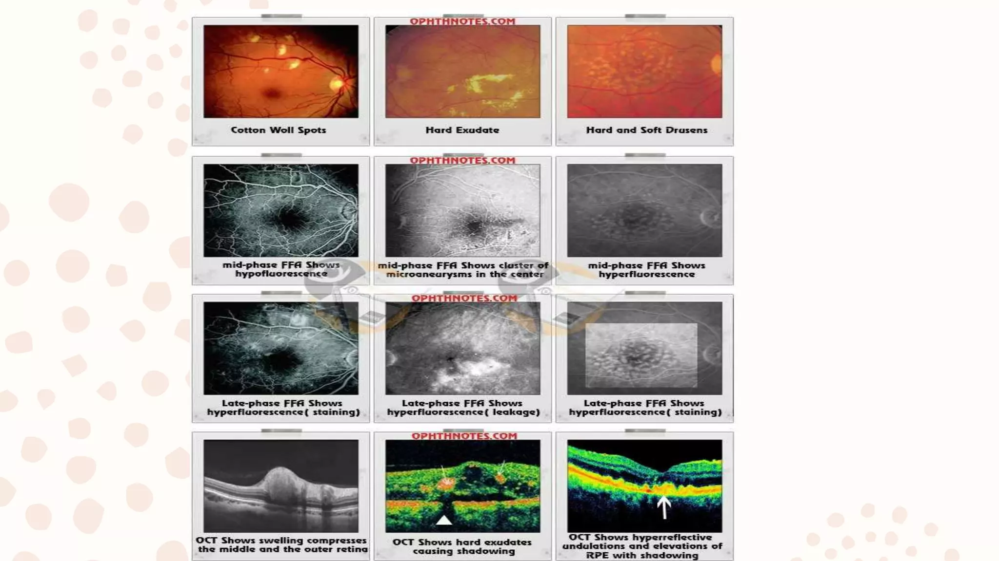 Macular function test | PPTX