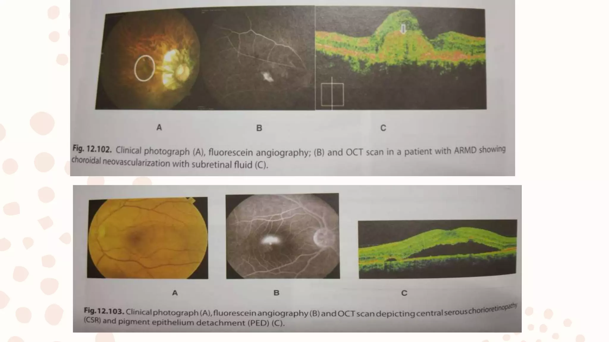 Macular function test | PPTX