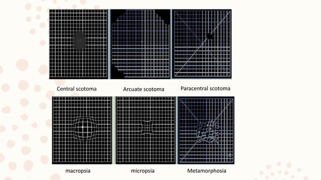 Macular function test | PPTX