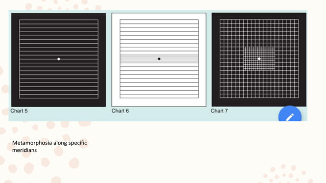 Macular function test | PPTX