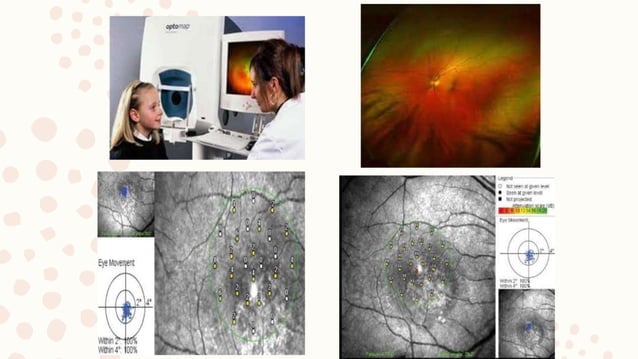 Macular function test | PPTX