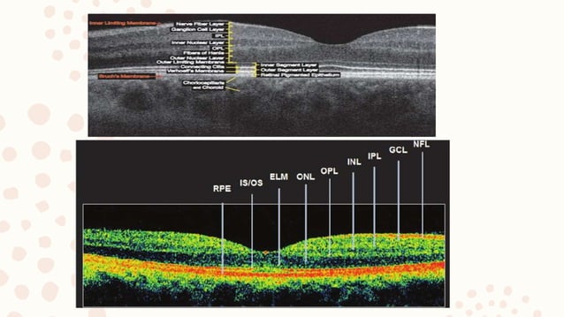 Macular function test | PPTX