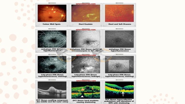 Macular function test | PPT
