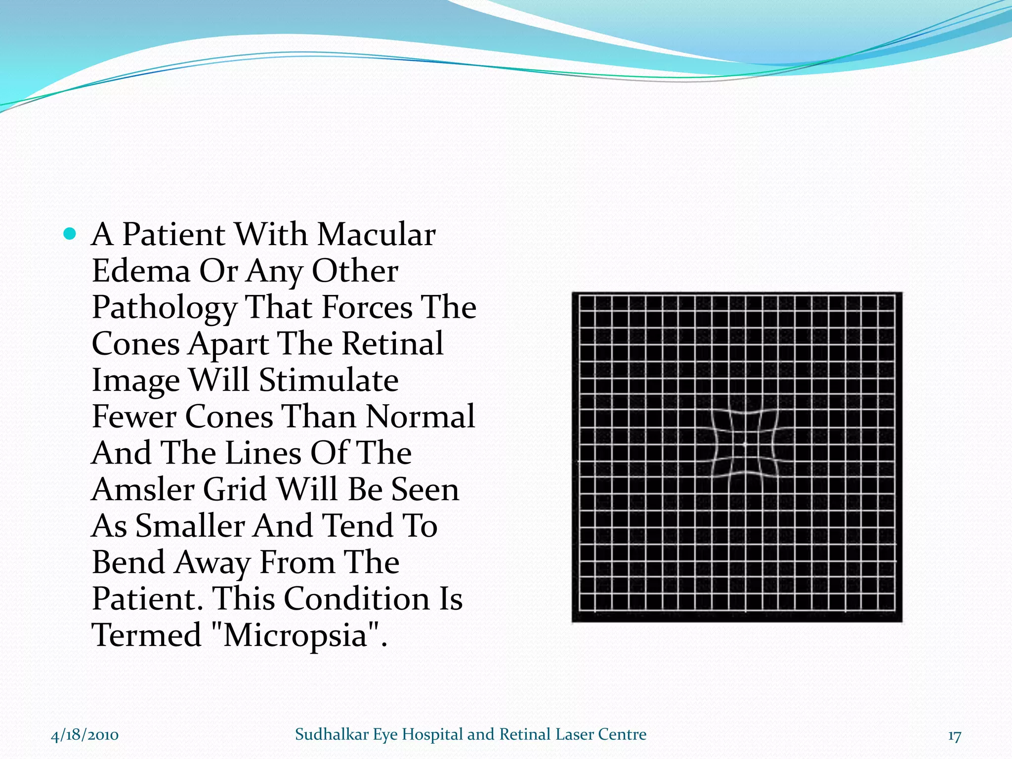 Macular function test and clinical assessment bos 3 1- 2010 | PPTX