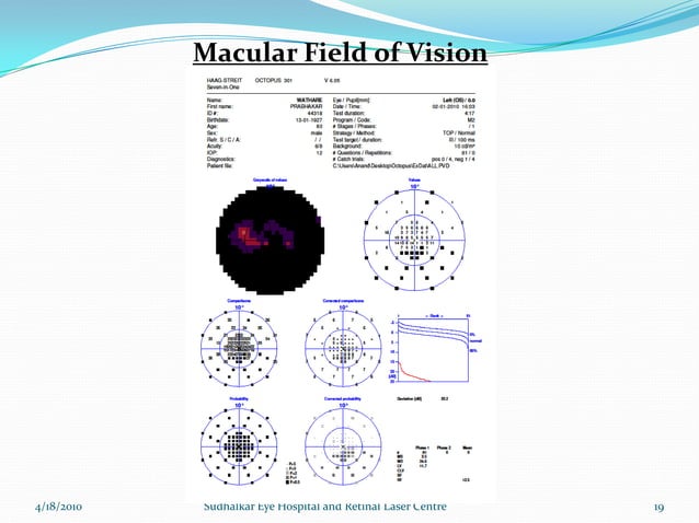 Macular function test and clinical assessment bos 3 1- 2010 | PPTX ...