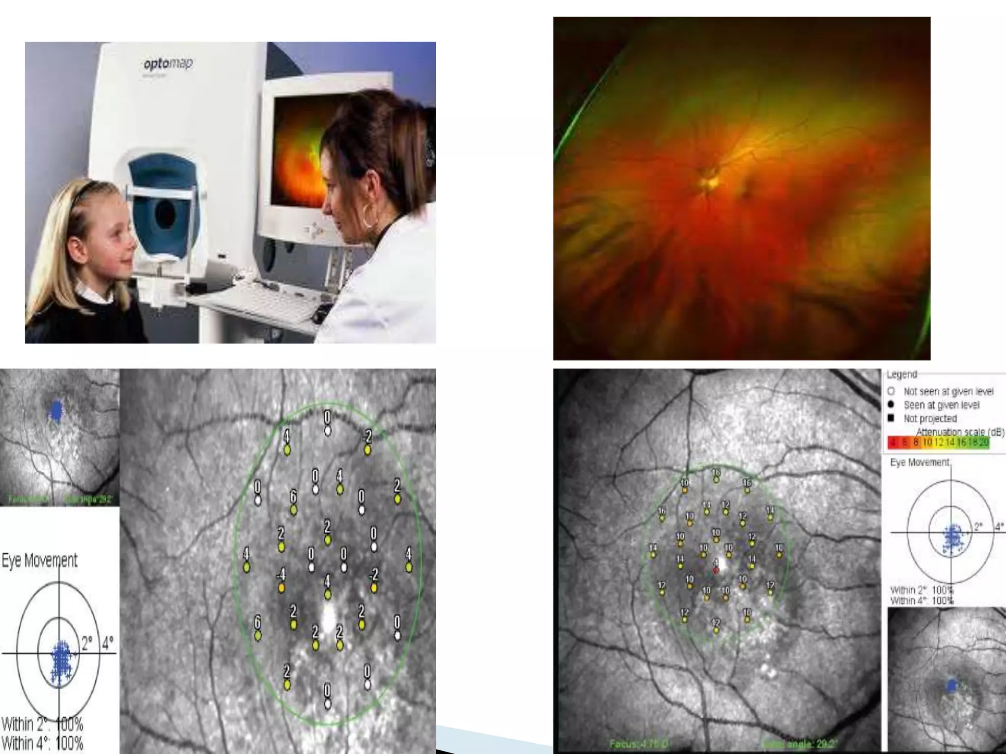 Macular function tests | PPTX