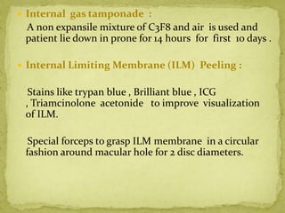 Macular hole | PPTX