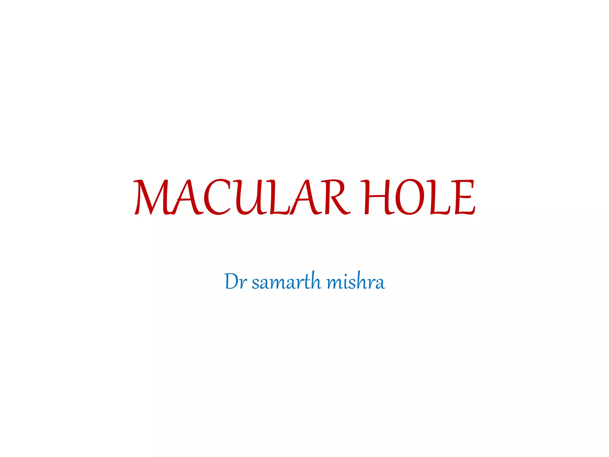 Macular hole | PPTX