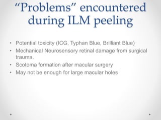 ILM Friend or Foe | PPTX | Eye and Vision Conditions | Diseases and ...