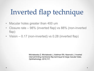 ILM Friend or Foe | PPTX