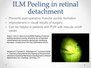 ILM Friend or Foe | PPTX | Eye and Vision Conditions | Diseases and ...