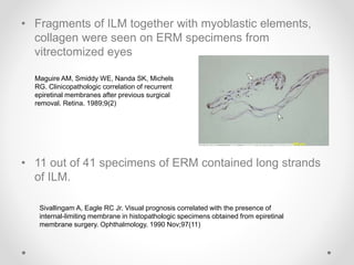 ILM Friend or Foe | PPTX